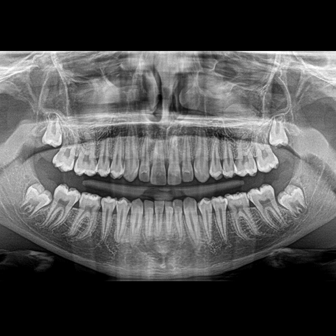 RADIOGRAFIA PANORÂMICA - Tomus