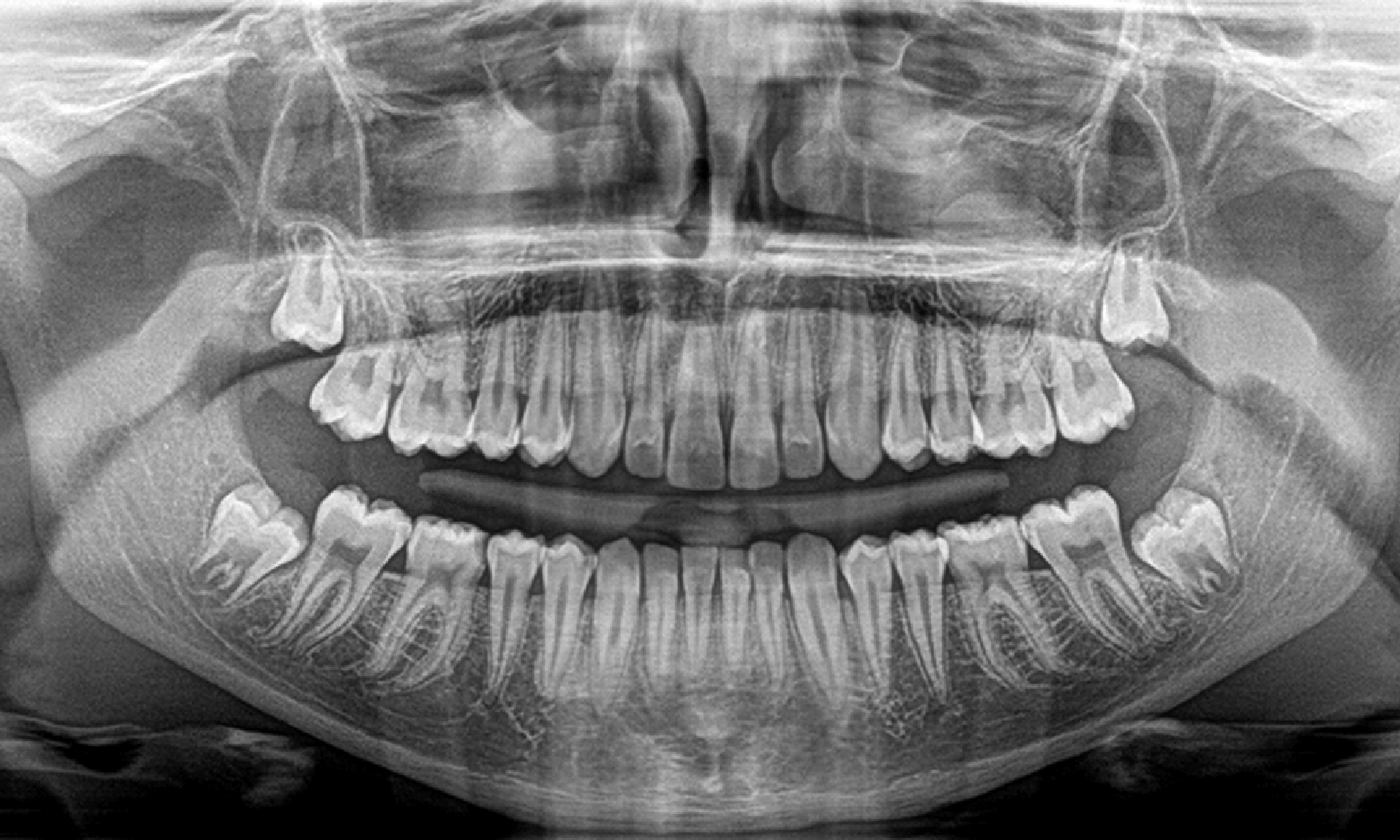 RADIOGRAFIA PANORÂMICA - Tomus